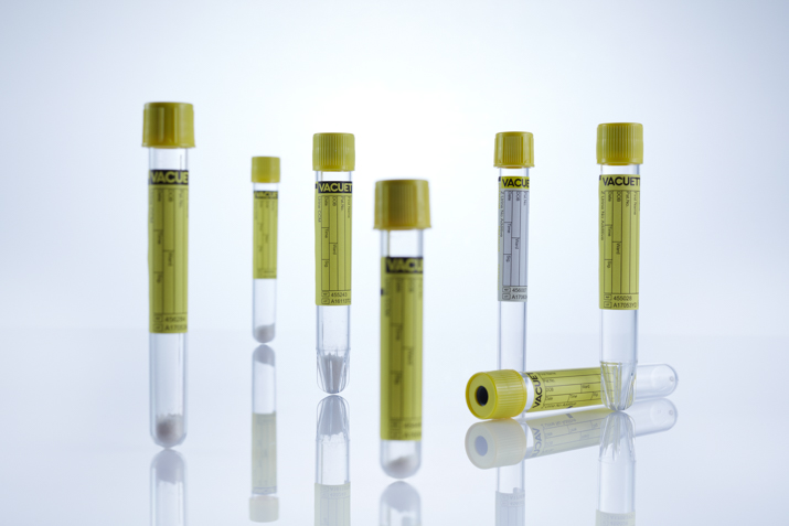 VACUETTE® Urine Tubes | Greiner Bio-One | www.gbo.com